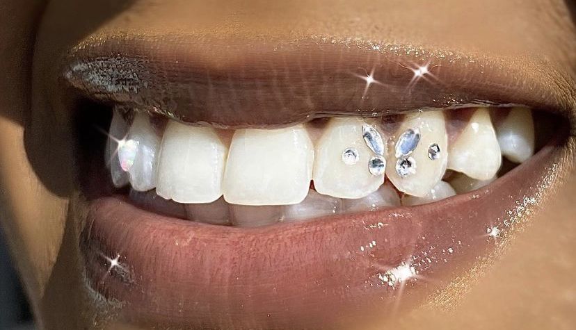 Kit strass dentaire & formation en ligne | Ma formation strass